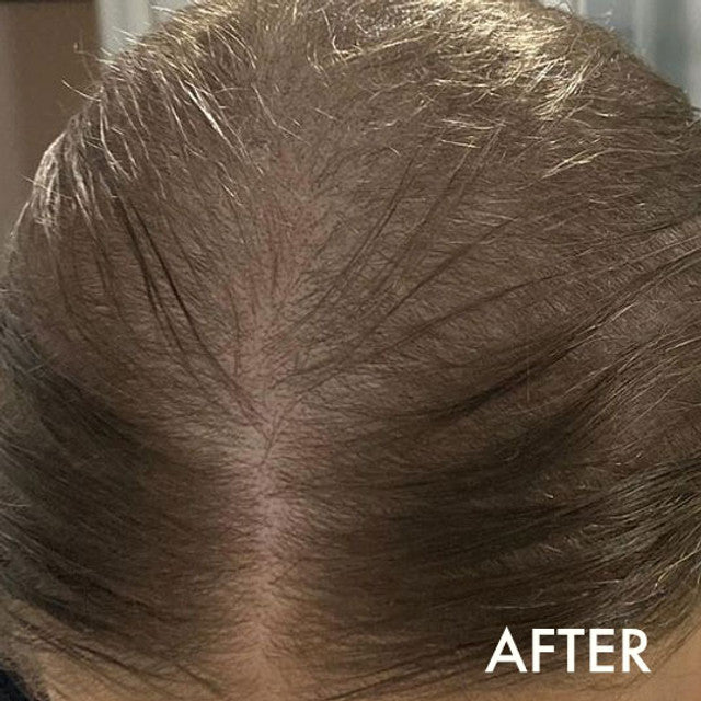 Rapid Hair Growth Pack | La Biosthetique – Monecious Hair Skin Health